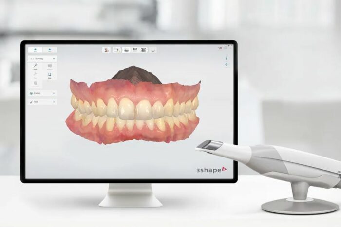 Escáner intraoral: qué es y para qué sirve - Clínica Dental Jaén