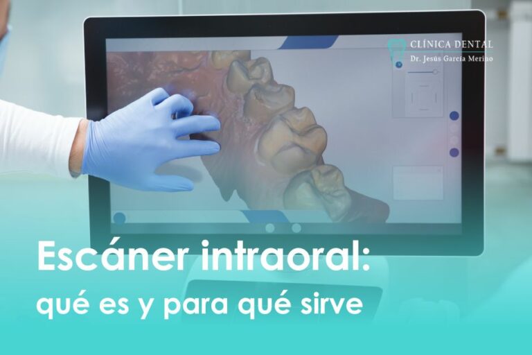 Escáner intraoral: qué es y para qué sirve - Clínica Dental Jaén