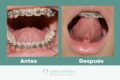 Frenillo bucal: ¿cuándo puede ser un problema? - Clínica Dental Jaén